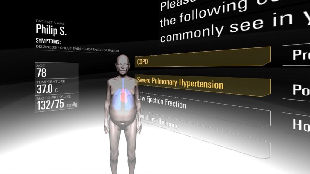 Virtual Reality In Healthcare - VR Heart Valve | SBA